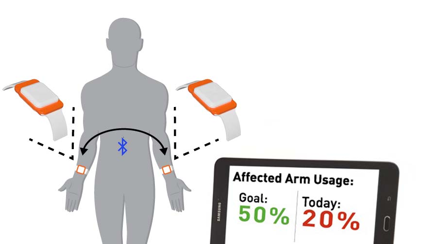 Rally | Wrist-worn sensors for home-based arm rehabilitation in stroke ...