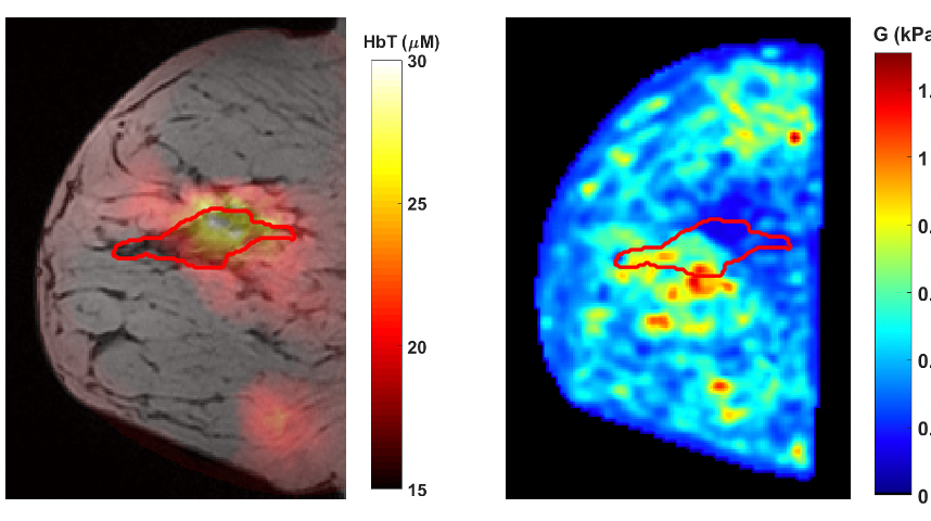 Rally | Breast Imaging with Combined Functional Optical and Magnetic Resonance Imaging