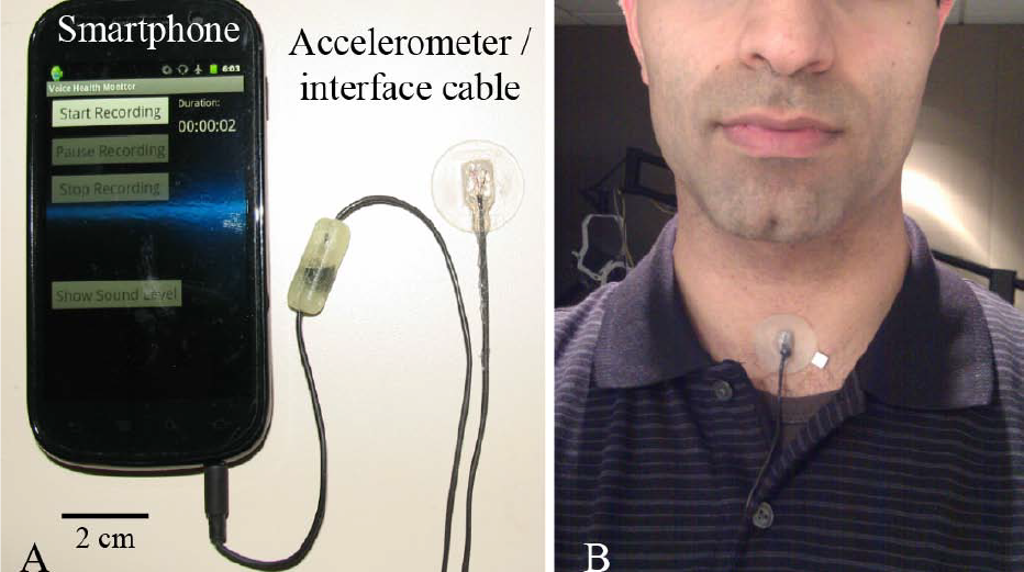 Rally | Ambulatory Voice Monitoring Study at the MGH Voice Center