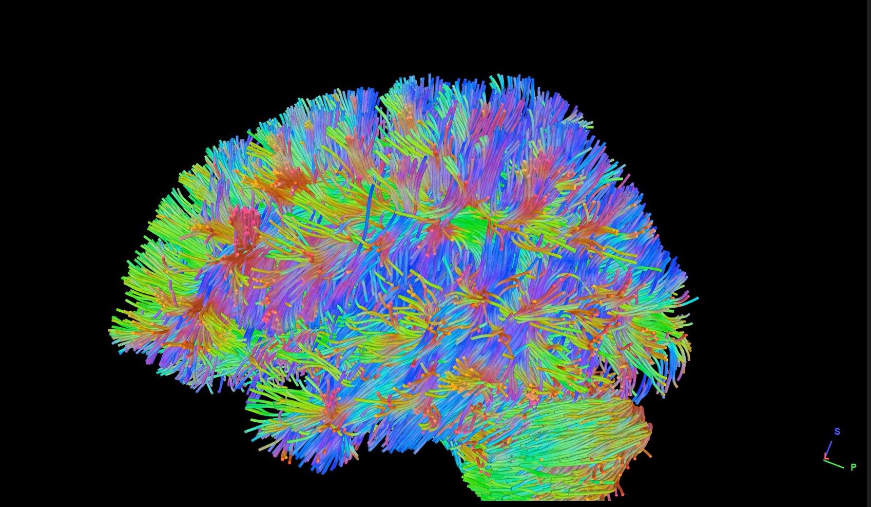 Rally | Studying Brain Connectivity using Brain Stimulation and ...