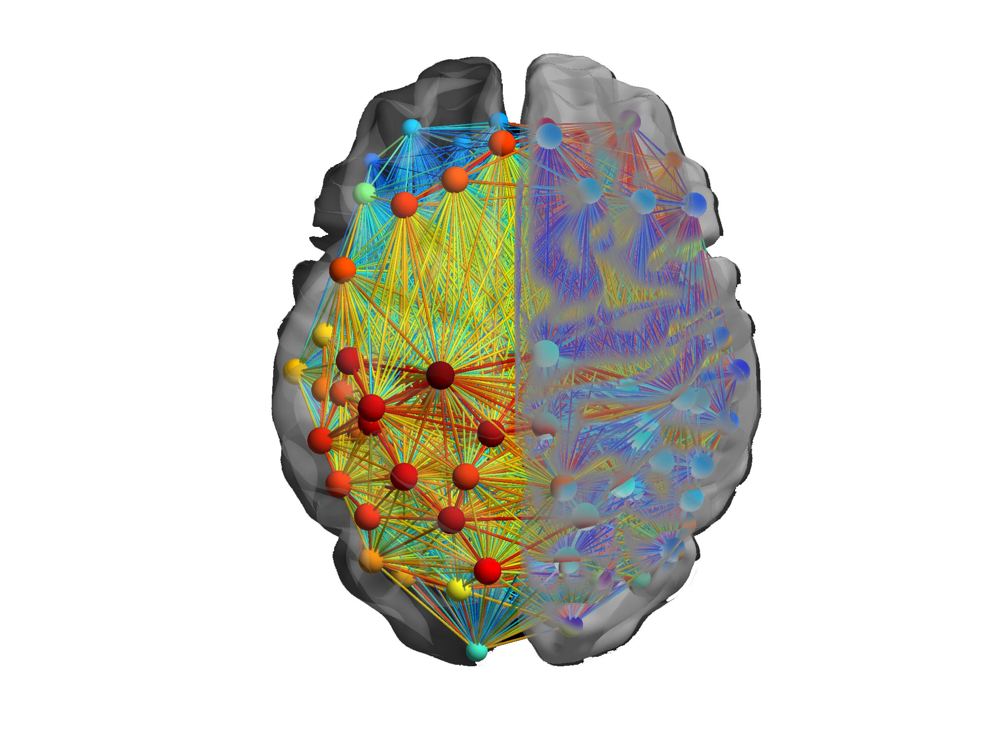 Rally | Sodium oxybate as a novel oral drug for spasmodic dysphonia